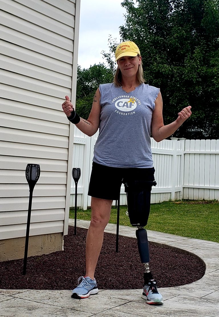 above-knee amputee | LIM Innovations